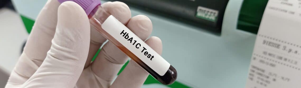 Prueba A1c | Insulinic of Florida | A1c Testing Center